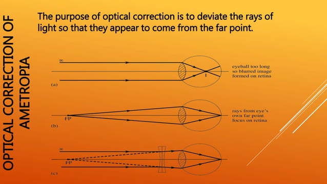 Optics of ametropia | PPTX