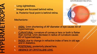 Optics of ametropia | PPTX