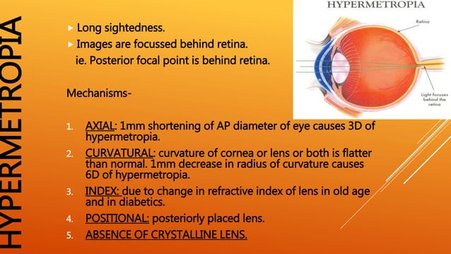 Optics of ametropia | PPTX