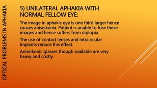 Optics of ametropia | PPTX