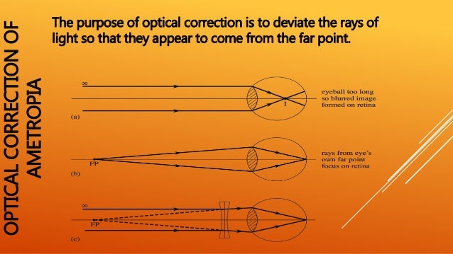 Optics of ametropia
