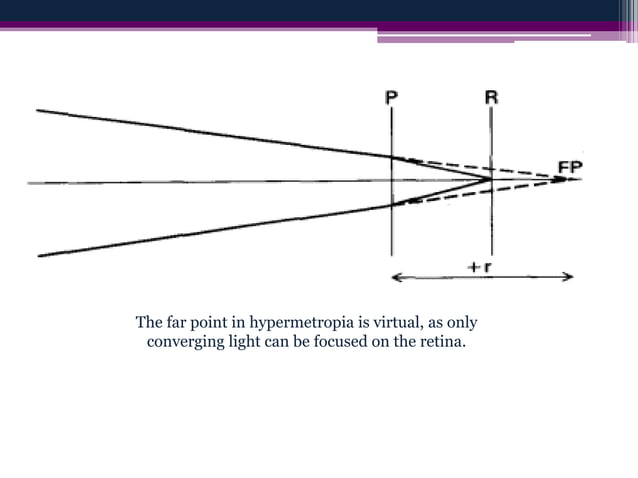 Optics of ametropia | PPTX
