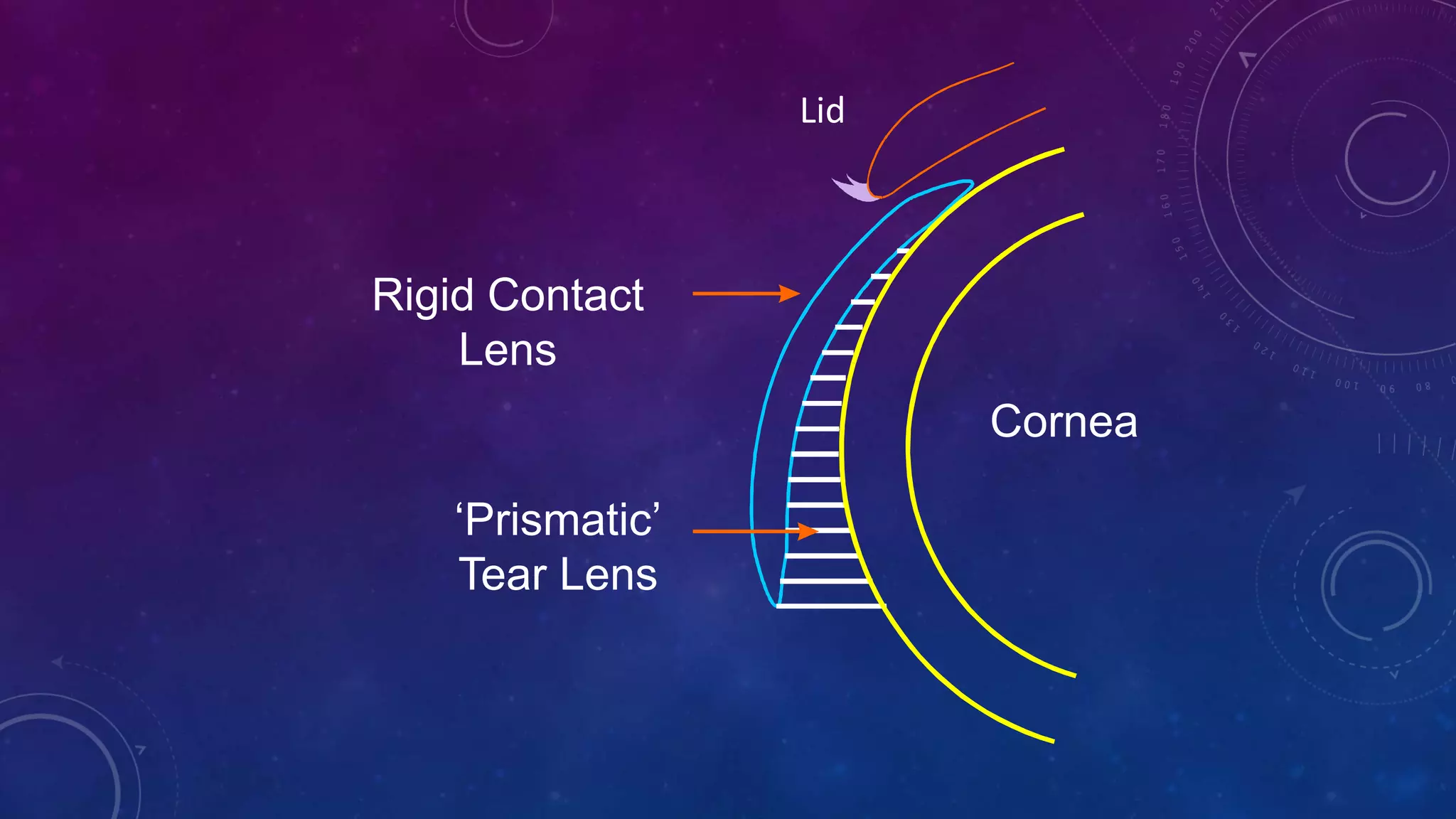OPTICS OF CONTACT LENSES | PPTX