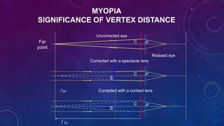 OPTICS OF CONTACT LENSES | PPTX