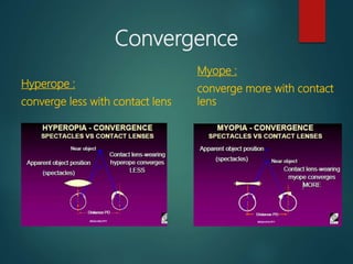 Optics of contact lens and nomenclature copy [repaired] (1) | PPTX