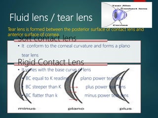 Optics of contact lens and nomenclature copy [repaired] (1) | PPTX