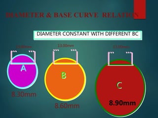 Optics of contact lens and nomenclature copy [repaired] (1) | PPTX