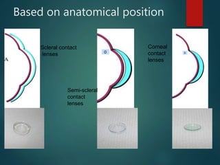 Optics of contact lens and nomenclature copy [repaired] (1) | PPTX
