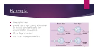Optics of eye | PPTX