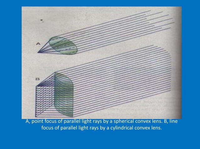 Optics of eyes | PPTX | Eye and Vision Conditions | Diseases and Conditions
