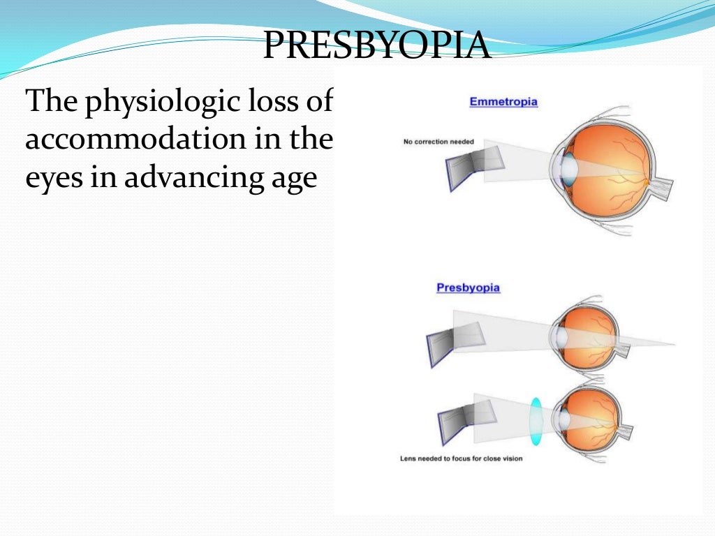 Optics of human eye & refractive errors