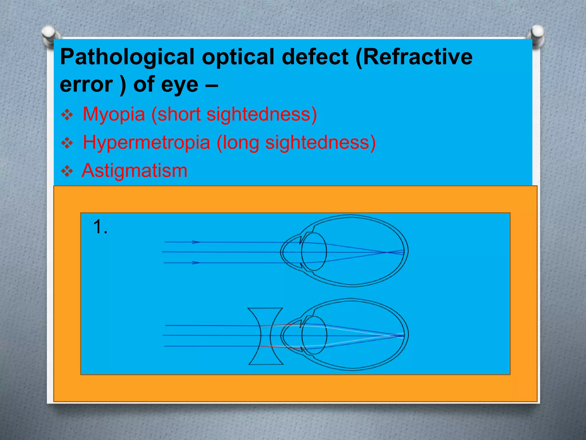 Optics of ocular structure | PPTX