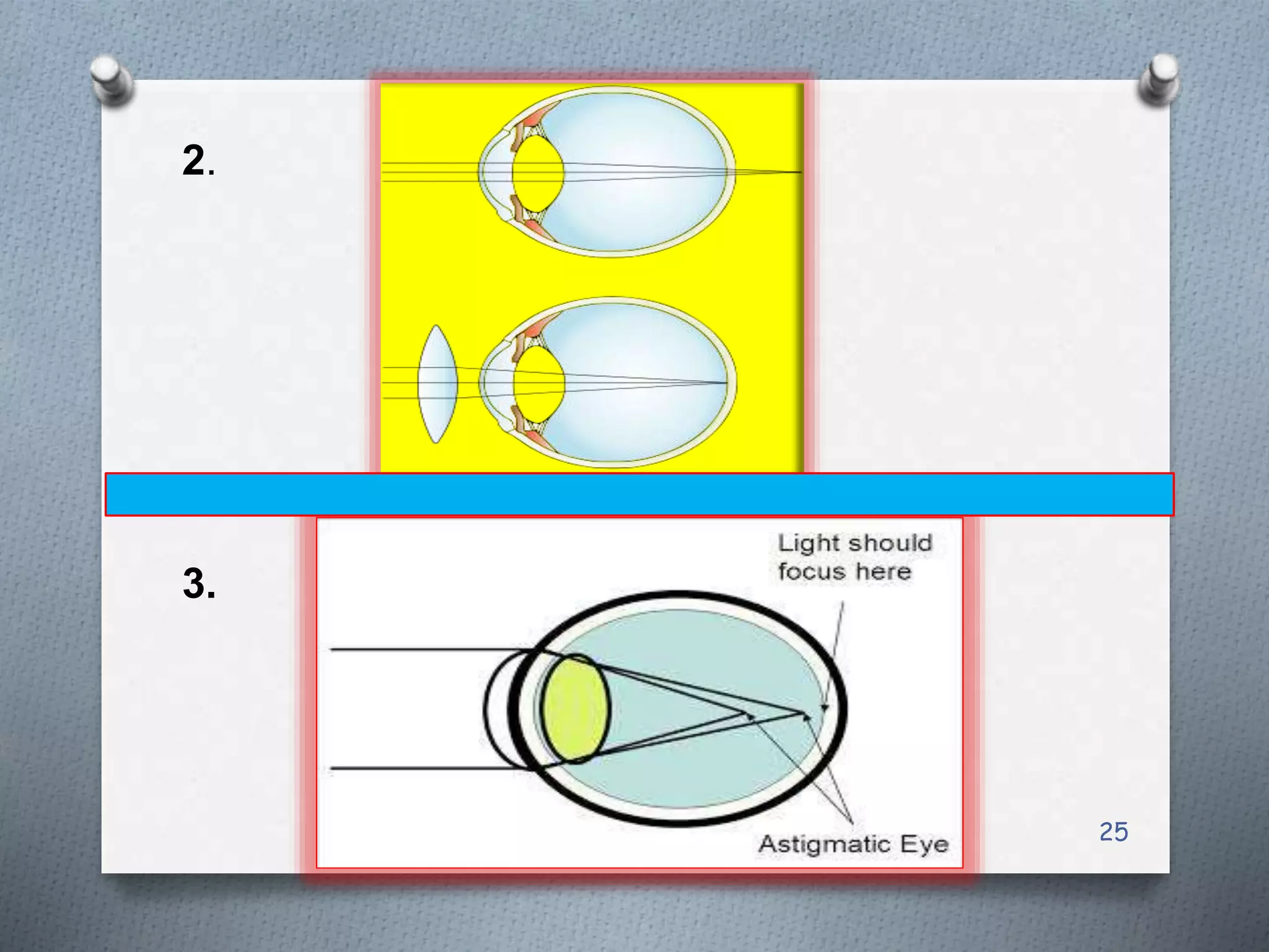 Optics of ocular structure | PPTX