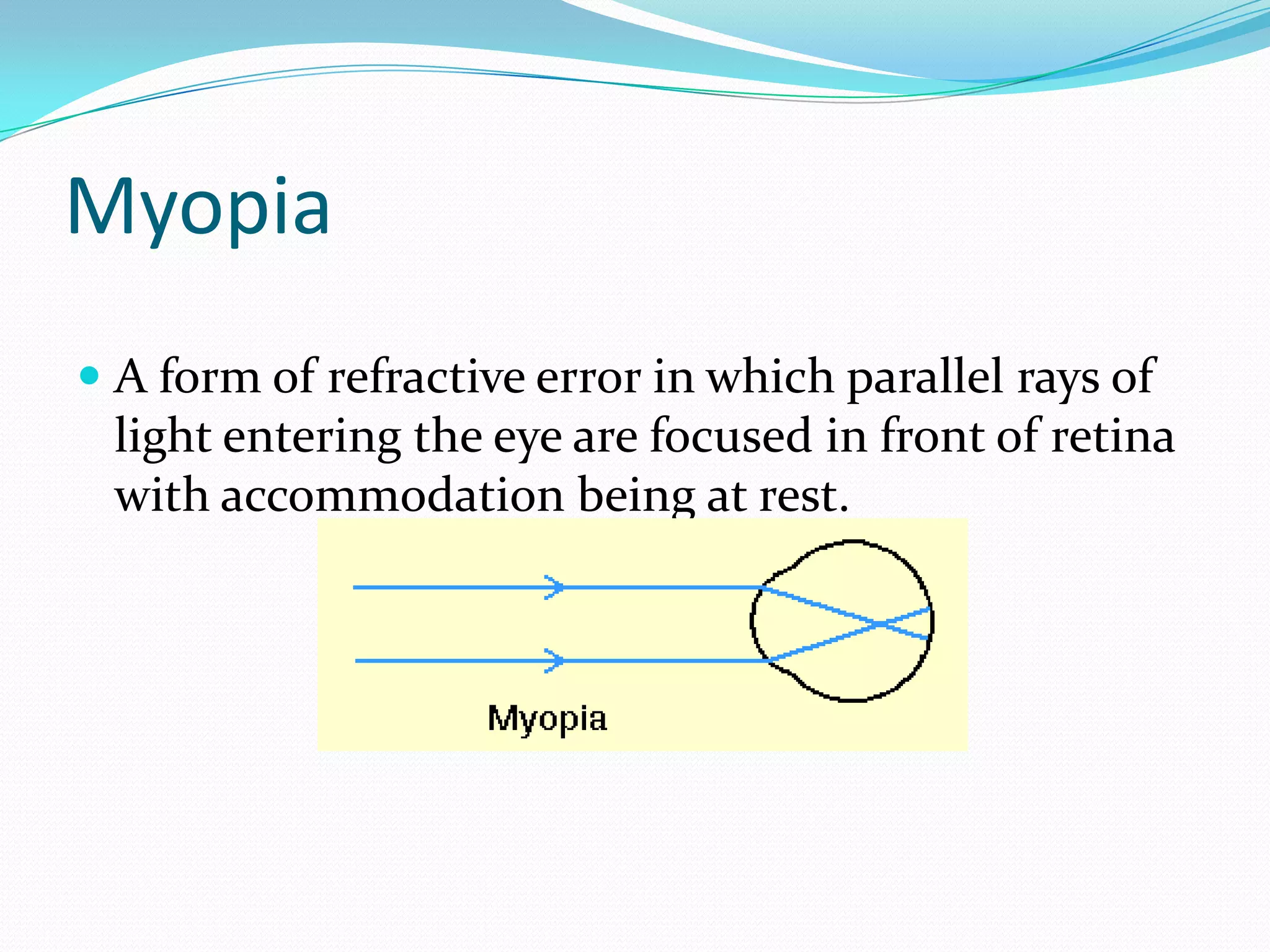 OPTICS OF HUMAN EYE & REFRACTIVE ERRORS | PDF