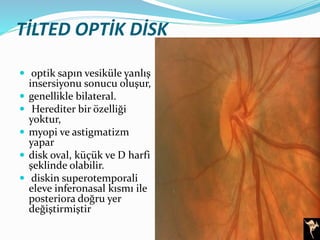 Optik disk konjenital anomalileri | PPTX