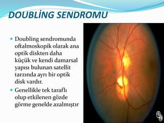 Optik disk konjenital anomalileri | PPTX