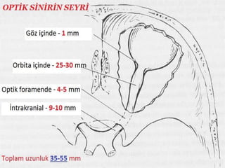 Optik disk konjenital anomalileri | PPTX