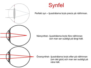 Optik ögat pp | PPT