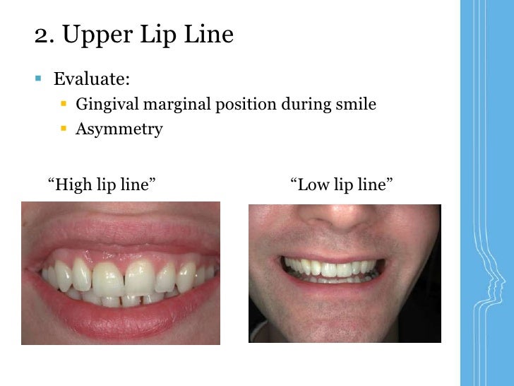 Optimal aesthetics IDA galway 2010