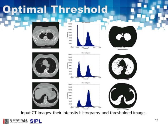 Optimal fuzzy rule based pulmonary nodule detection | PPT Optimal fuzzy rule based pulmonary nodule detection | PPT