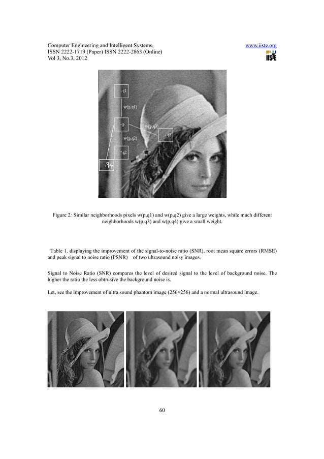Optimal Nonlocal Means Algorithm For Denoising Ultrasound Image Pdf