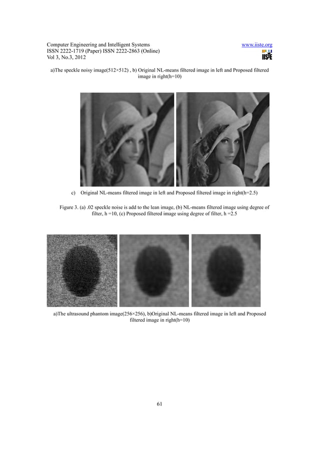 Optimal nonlocal means algorithm for denoising ultrasound image | PDF