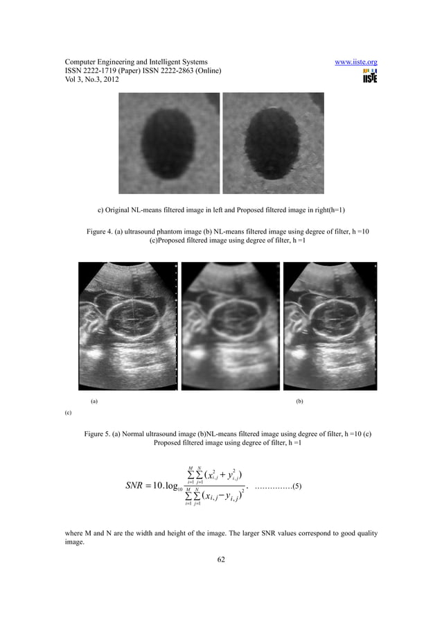 Optimal nonlocal means algorithm for denoising ultrasound image | PDF