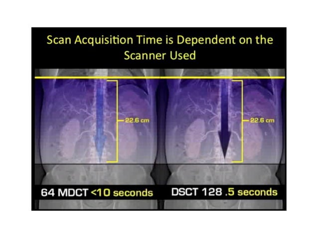 Optimization of ct scan protocol in acute abdomen 2003 revised aa | PPT