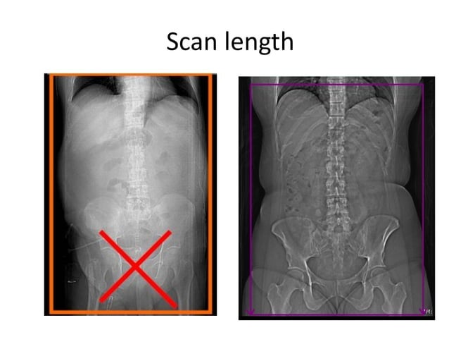 Optimization of ct scan protocol in acute abdomen 2003 revised aa | PPT