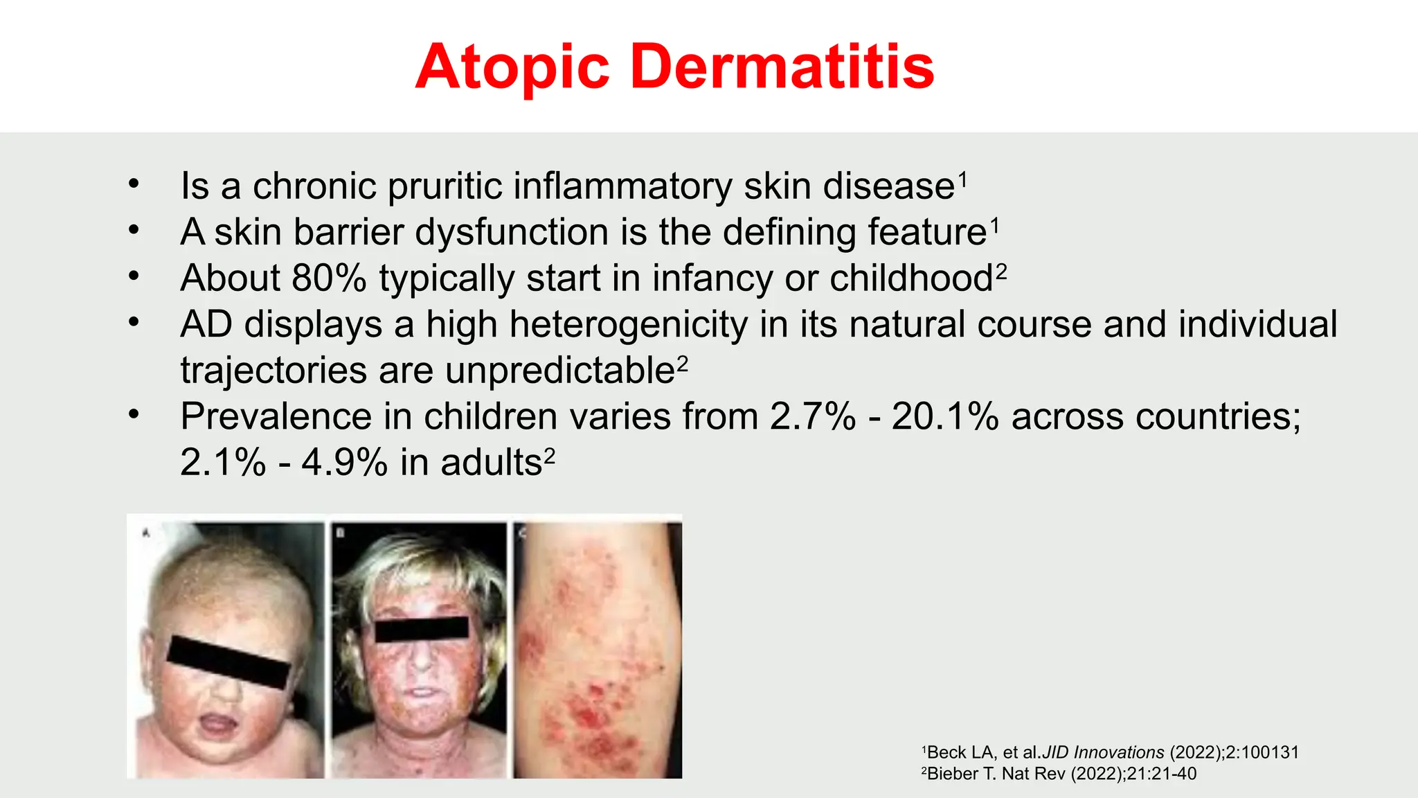 Optimizing Filaggrin and Ad-Resyl Dermocosmetic for Atopic Dermatitis Patient Management.pptx