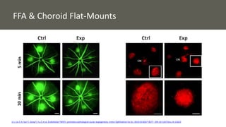 Optimizing image guided laser-induced choroidal neovascularization in ...