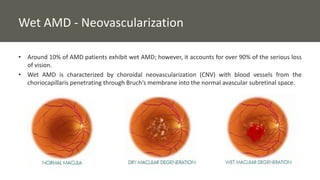 Optimizing image guided laser-induced choroidal neovascularization in ...