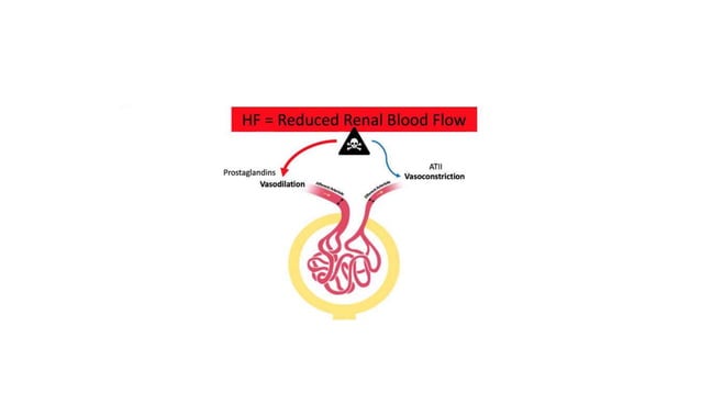 Optimizing medical therapy for heart failure with reduced ejection ...
