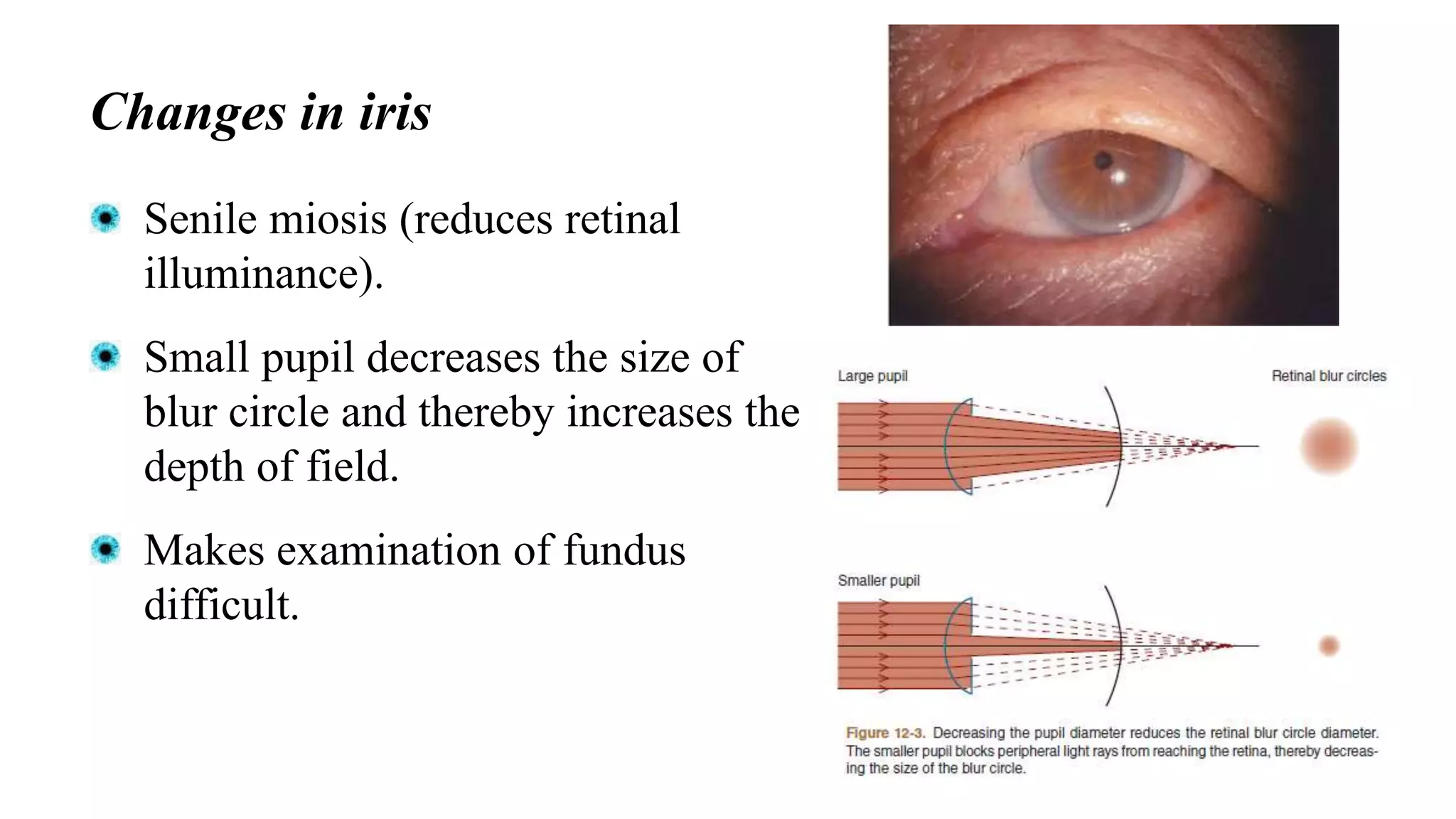Optometric examination and management of geriatric problems.pptx