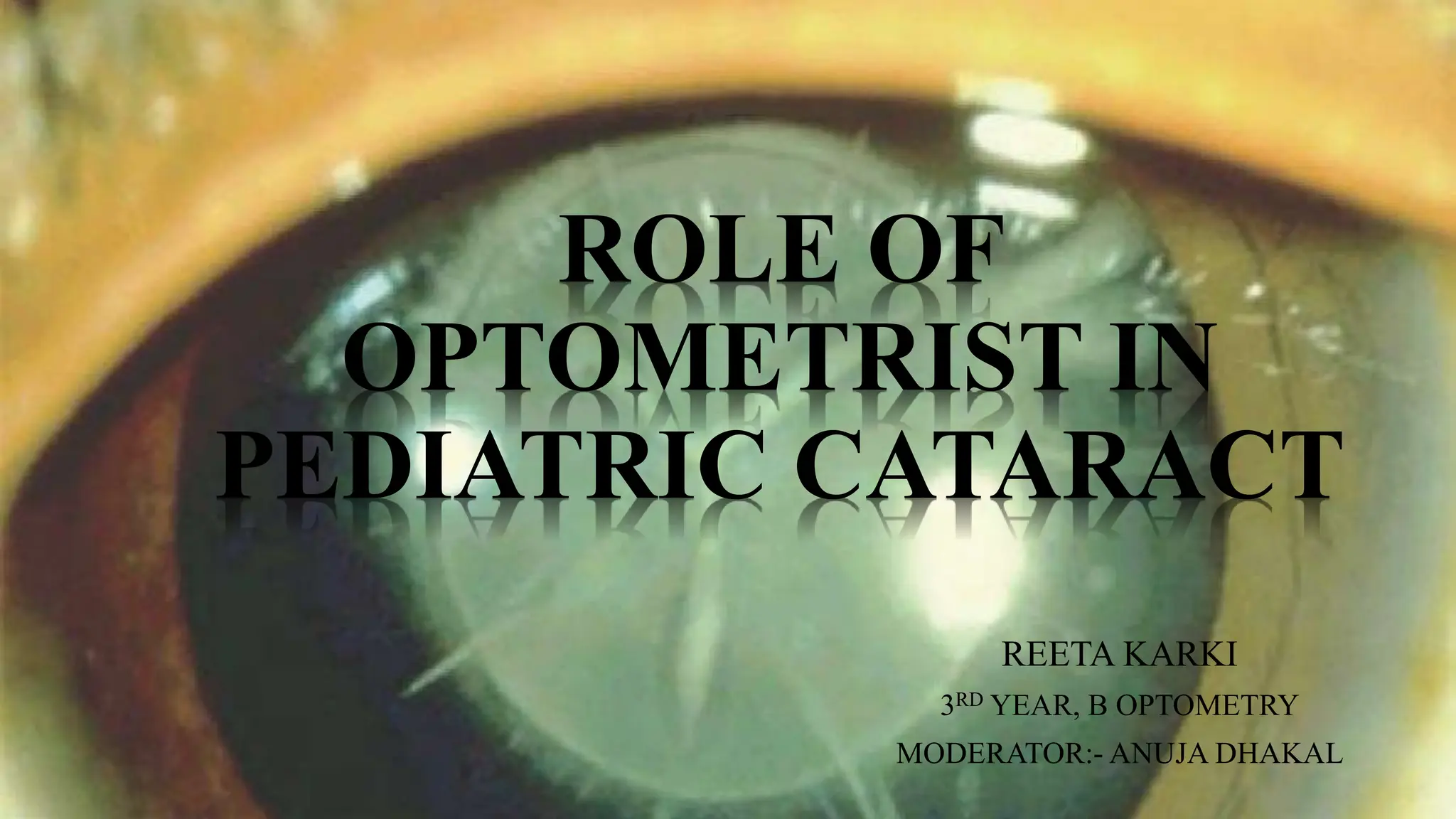 Role of Optometrist in Pediatric Cataract | PPT