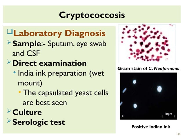 Opto mycology ppt2024.pptx mycology or fungus | PPT