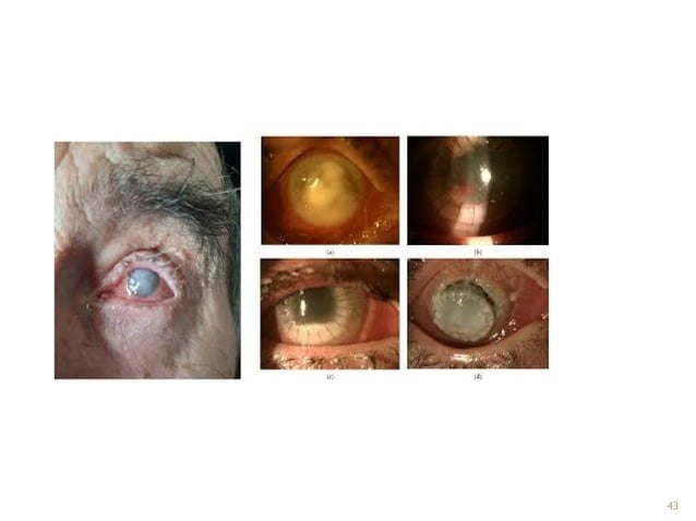 Opto mycology ppt2024.pptx mycology or fungus | PPT