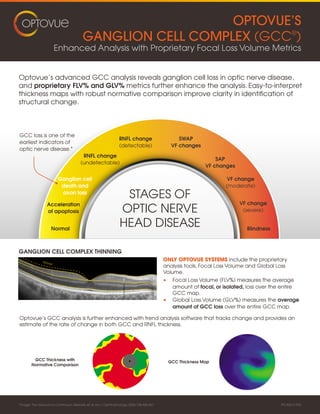 Optovue's Ganglion Cell Complex | PDF