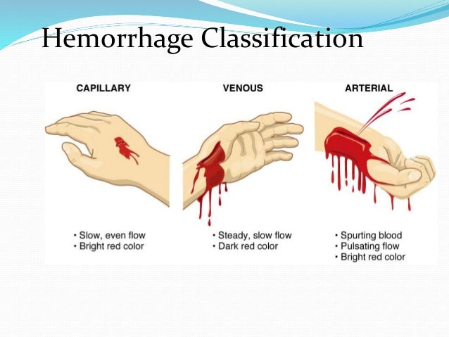 Haemorrhage and Shock: Relevance in Periodontal Surgery