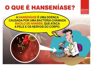 O que e hanseniase | PPT