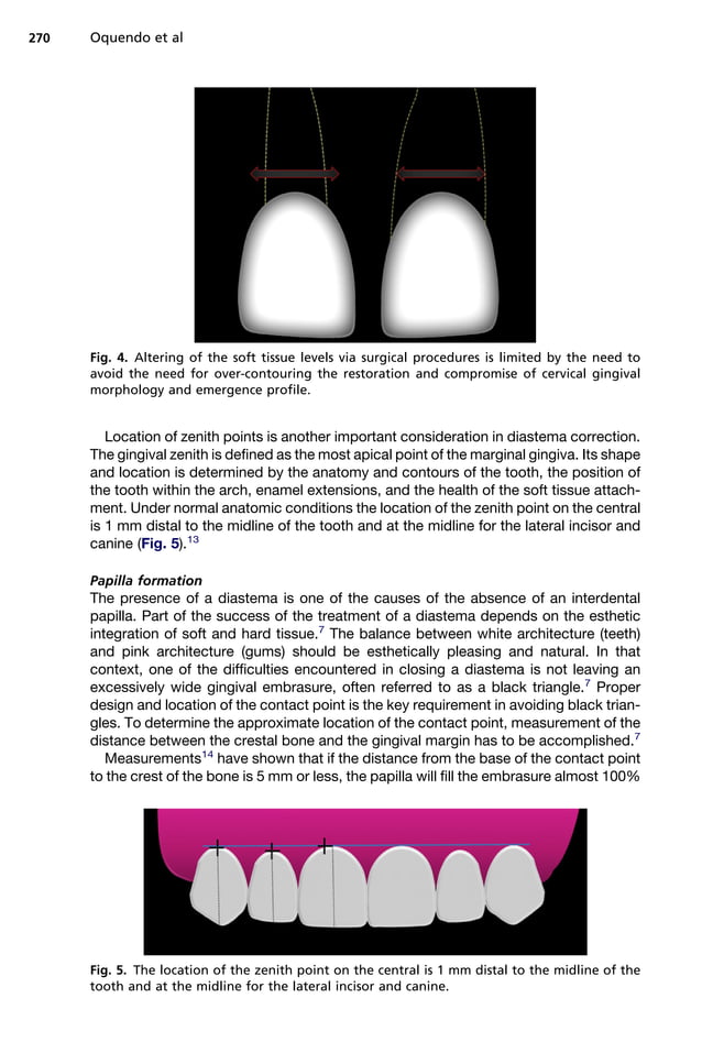 Diastema Correction of Excessive Spaces | PDF | Dental Health ...