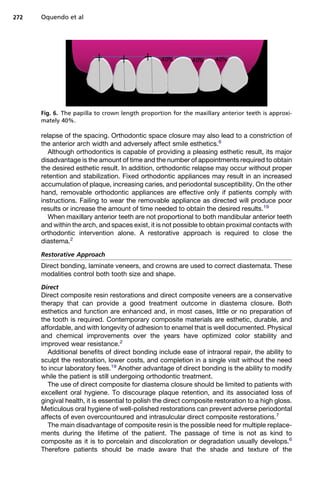 Diastema Correction of Excessive Spaces | PDF