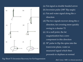 Ir sequence | PPT