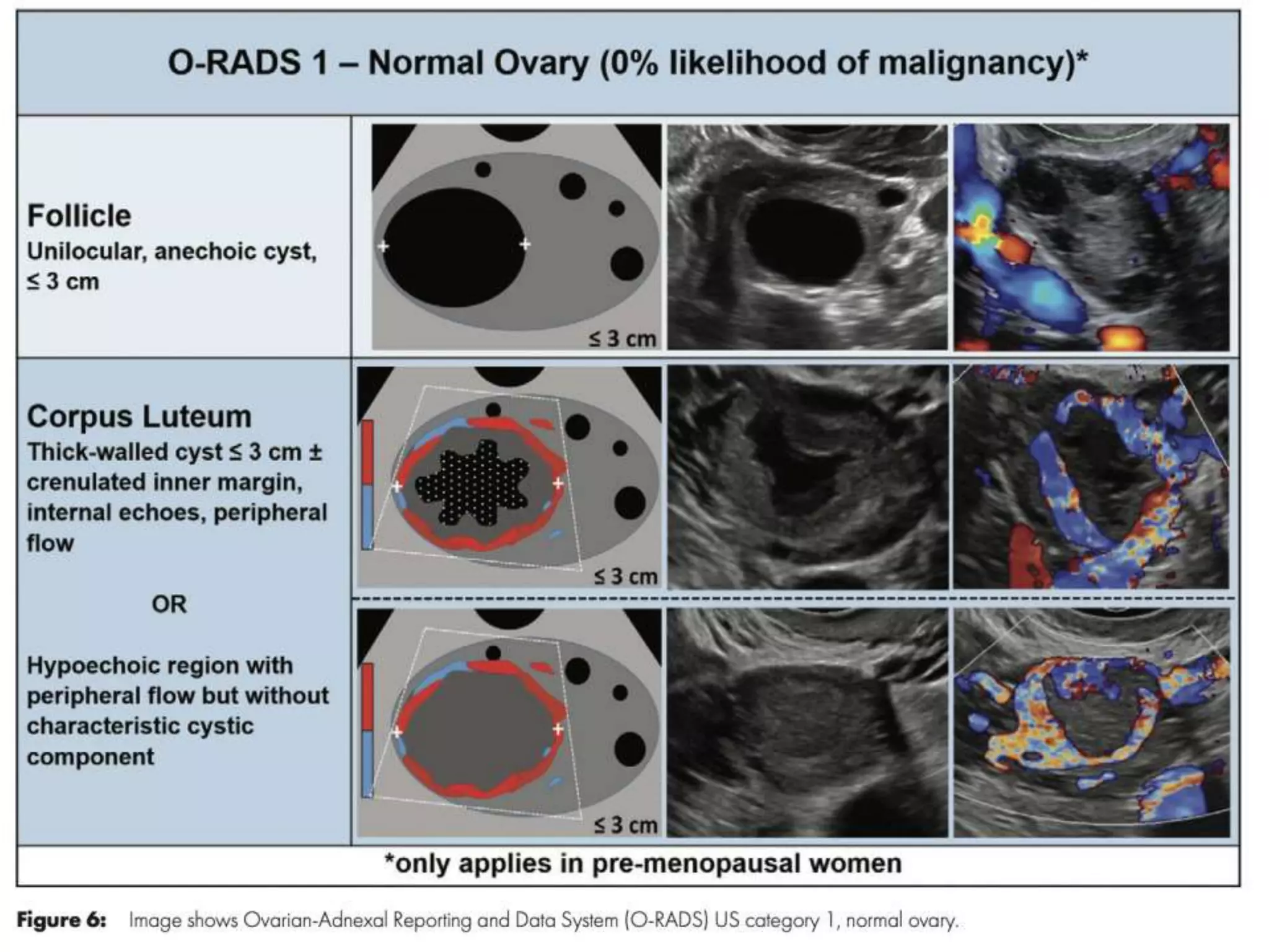 O'rads Radiology 2020 | PPTX
