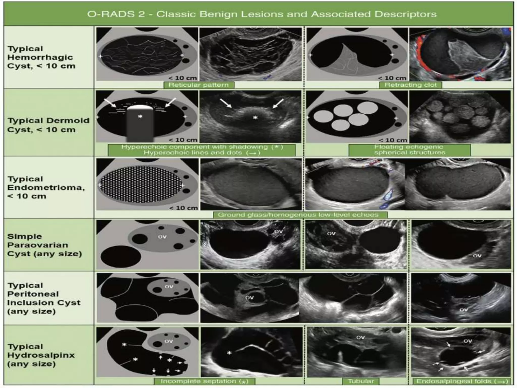 O'rads Radiology 2020 | PPTX