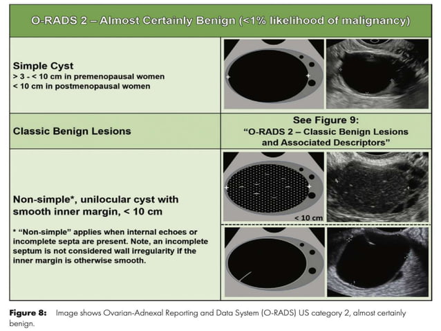 O'rads Radiology 2020 | PPTX
