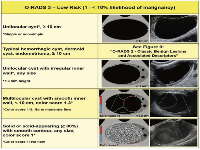 O'rads Radiology 2020 | PPTX