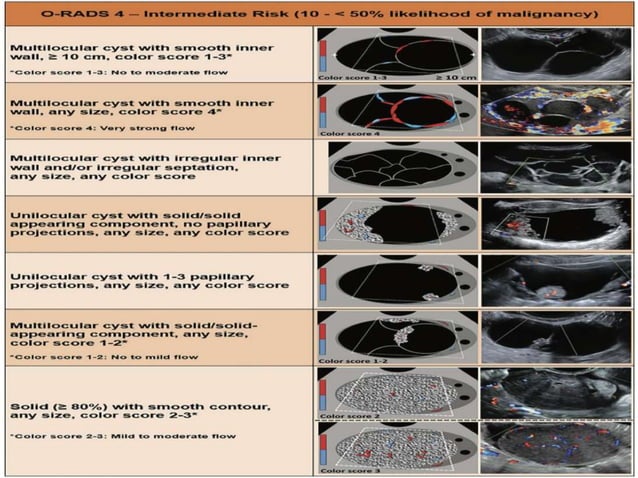 O'rads Radiology 2020 | PPTX
