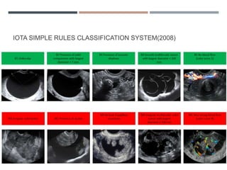 O'rads Radiology 2020 | PPTX