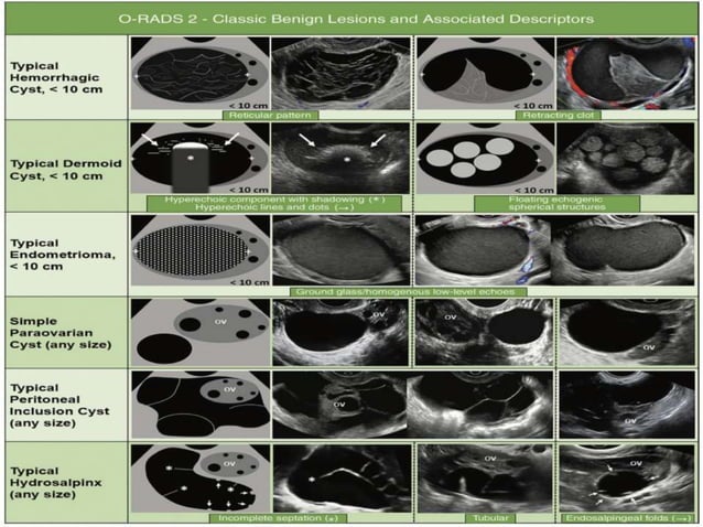 O'rads Radiology 2020